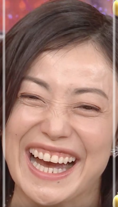 菅野美穂の顔変わった？劣化したとの声も！ 整形外科出入りの噂も徹底調査｜芸能summary